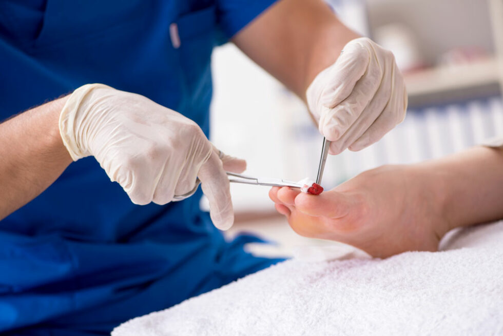 How To Care For An Open Wound The Right Way — WoundCare University
